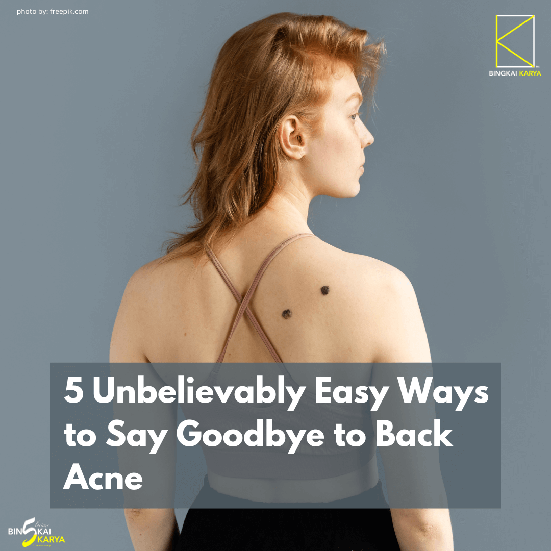 5 Unbelievably Easy Ways to Say Goodbye to Back Acne